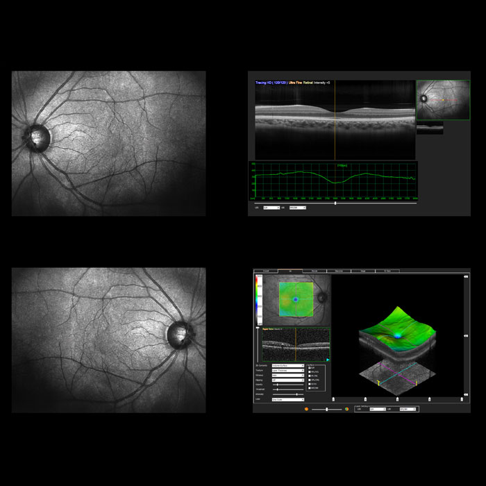 Technology - Family Eyecare Associates